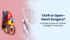 Understanding Pericardiectomy Surgery: A Complete Guide